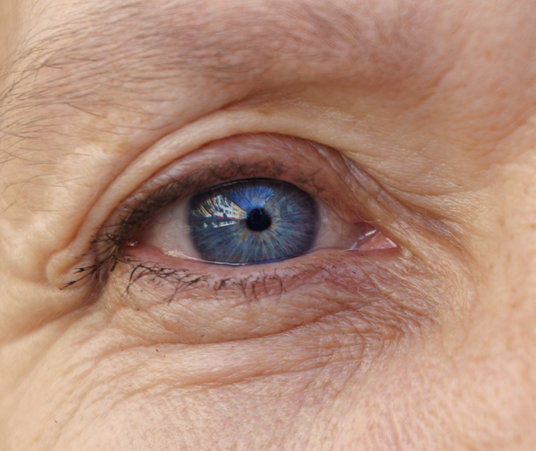 New drug for dry AMD - your questions answered - Macular Society