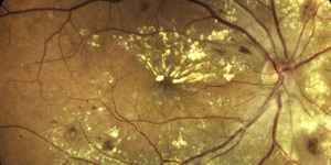 What is the macula? Why is it important? - Macular Society